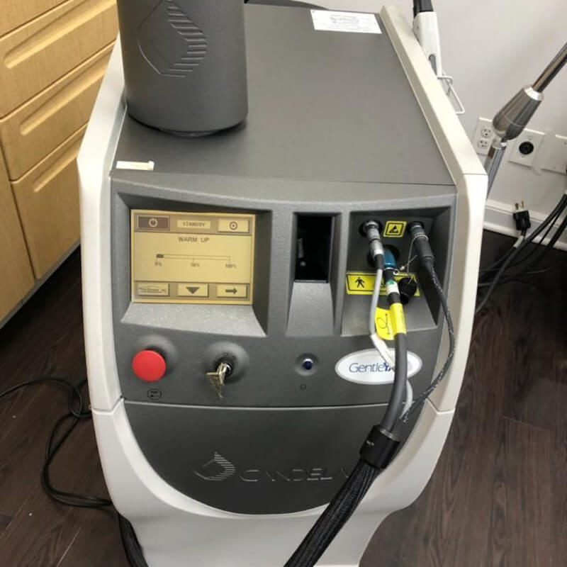 CANDELA GENTLEYAG MINI - CosmeticLasers.com