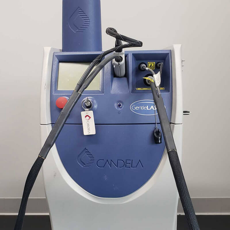 CANDELA MINI GENTLELASE - CosmeticLasers.com